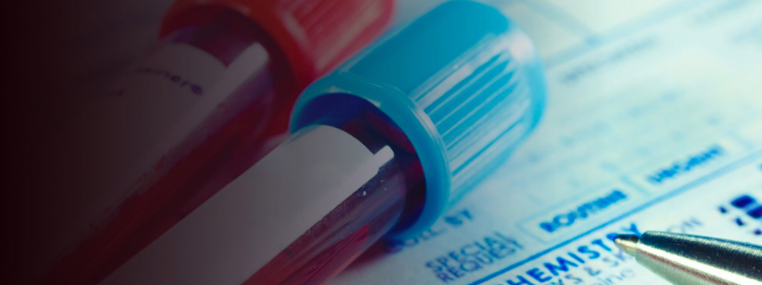 DWI Blood Test Results | BAC + DWI Tests | Sellers Law Firm